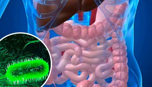 Tratamento da cólera - Melhor Com Saúde