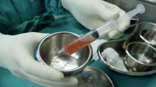 Ascite: o que é e como tratá-la - Melhor com Saúde