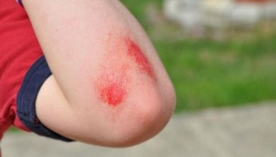 Sálvia e mel para tratar cortes e arranhões - Melhor com Saúde