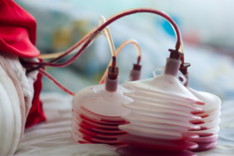 Tipos de drenos cirúrgicos e cuidados