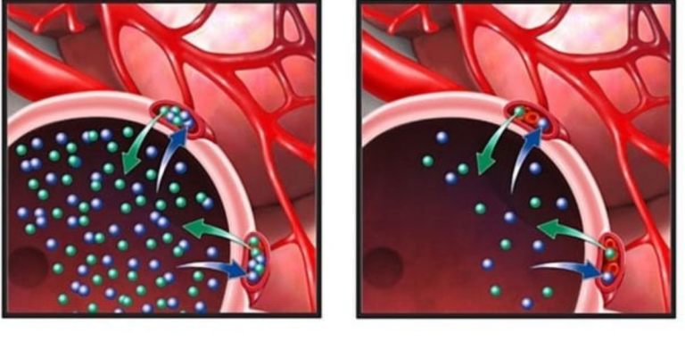 O perigo de sofrer uma embolia gasosa - Melhor Com Saúde